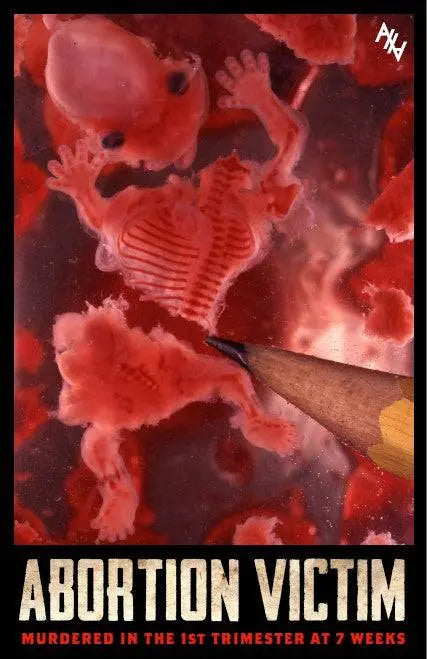 Activism Bundle | Abolitionists Rising Gear Store